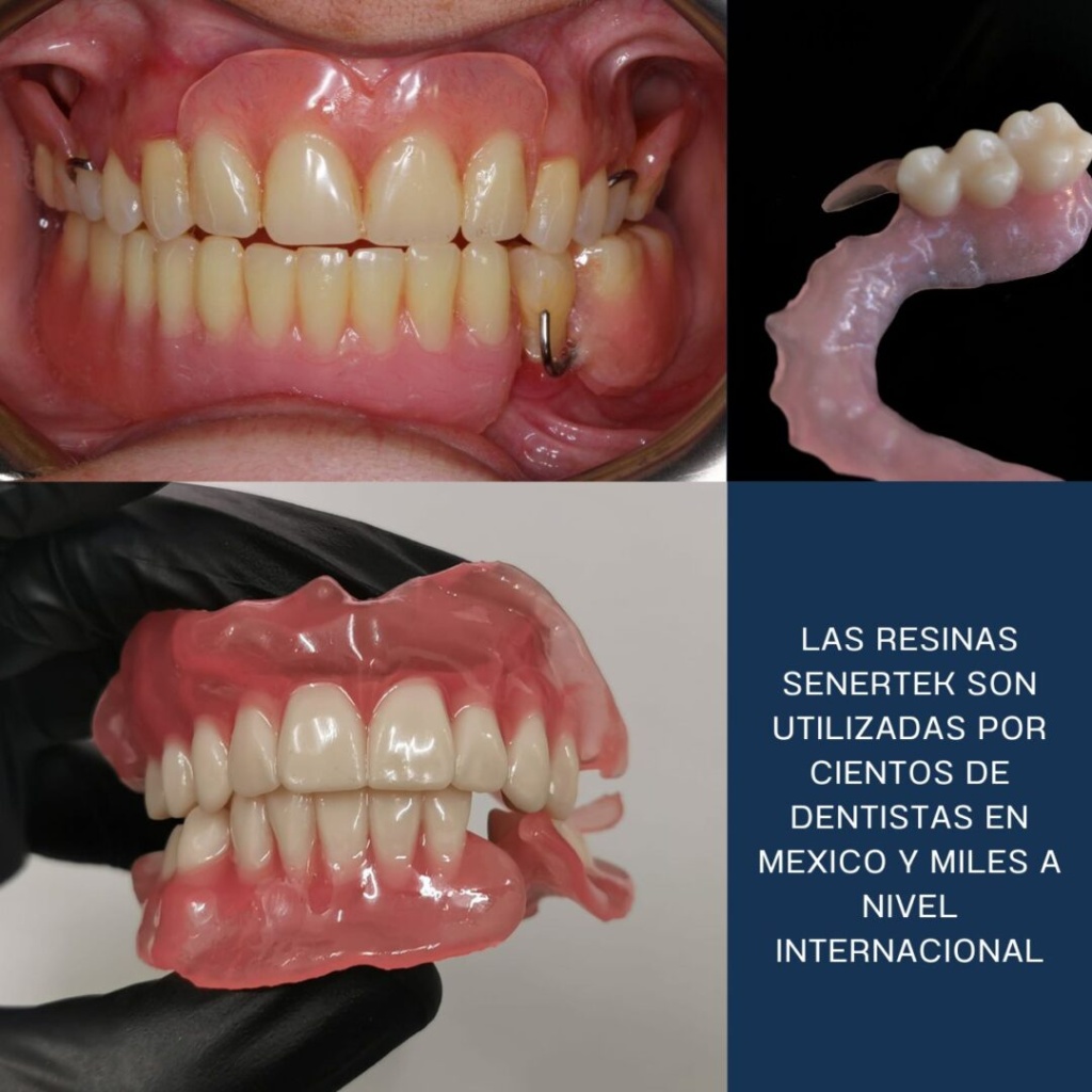 Senertek Denture Flexo | Comprar en Caballero 3D